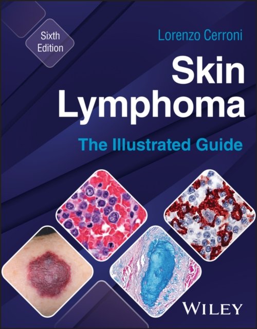 Skin Lymphoma - The Illustrated Guide | ARK Bokhandel